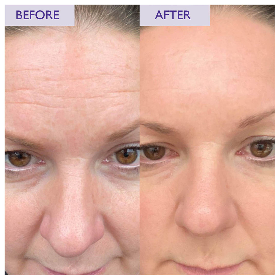 Tripeptide-1 Skin Care - Tripeptide-1 Benefits for Skin – SKINICIAN