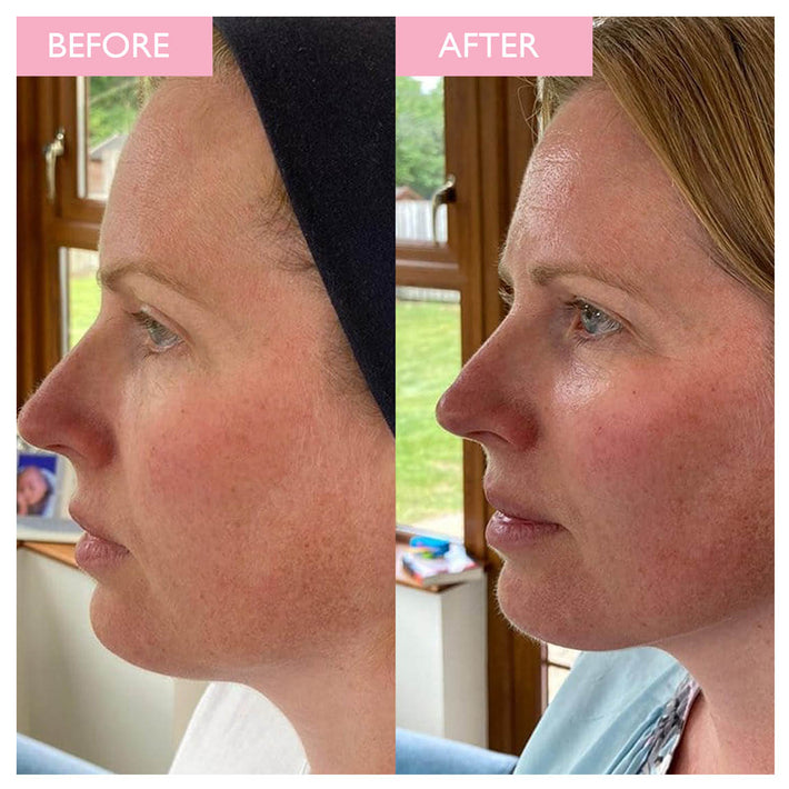 Saccharide Isomerate for Skin – SKINICIAN