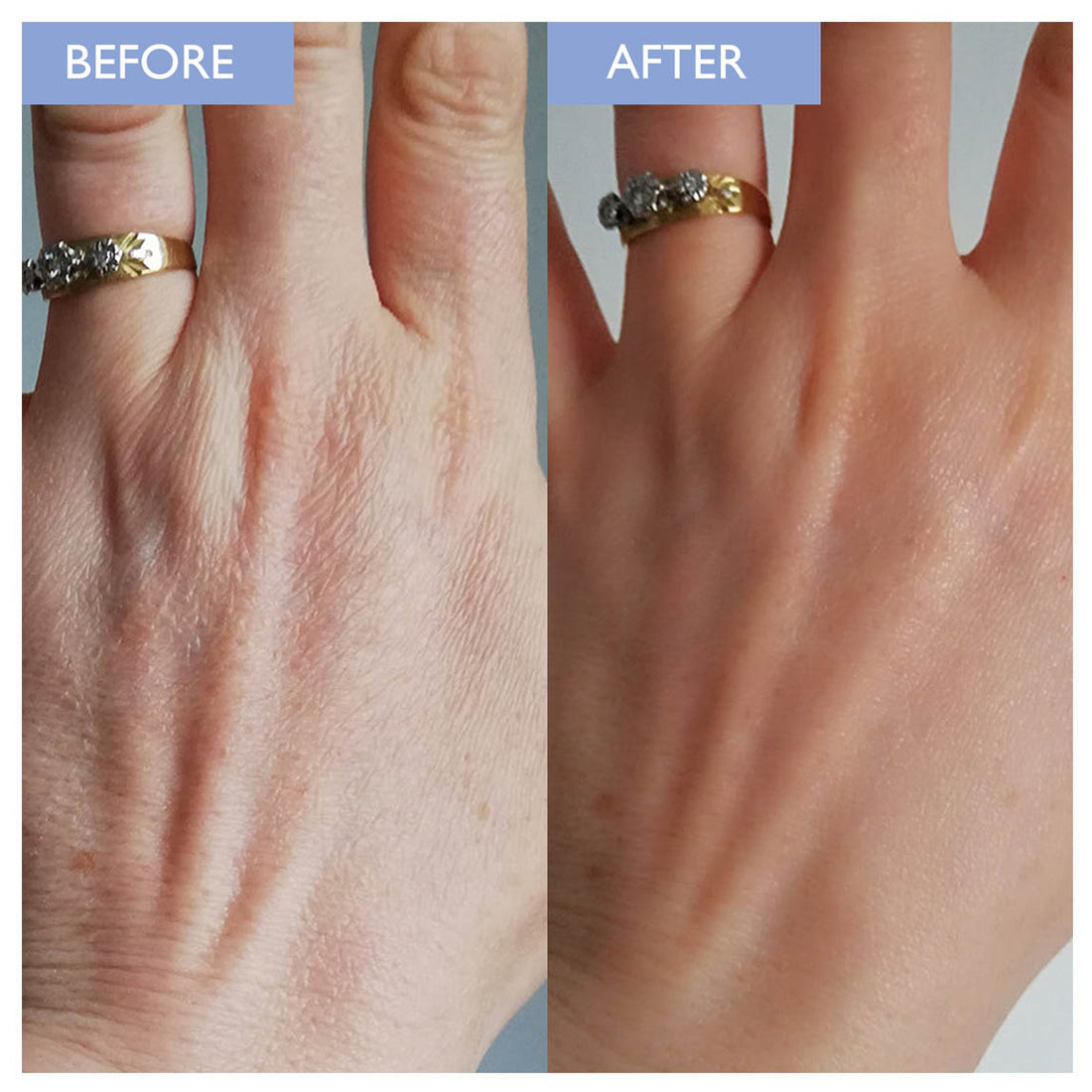 Glycerin for Skin – SKINICIAN