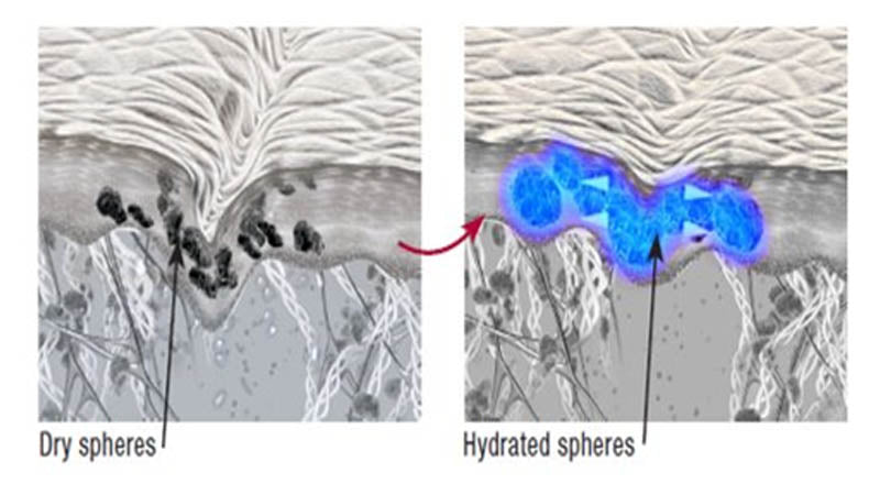 Hyaluronic Spherical Technnology for Skin – SKINICIAN