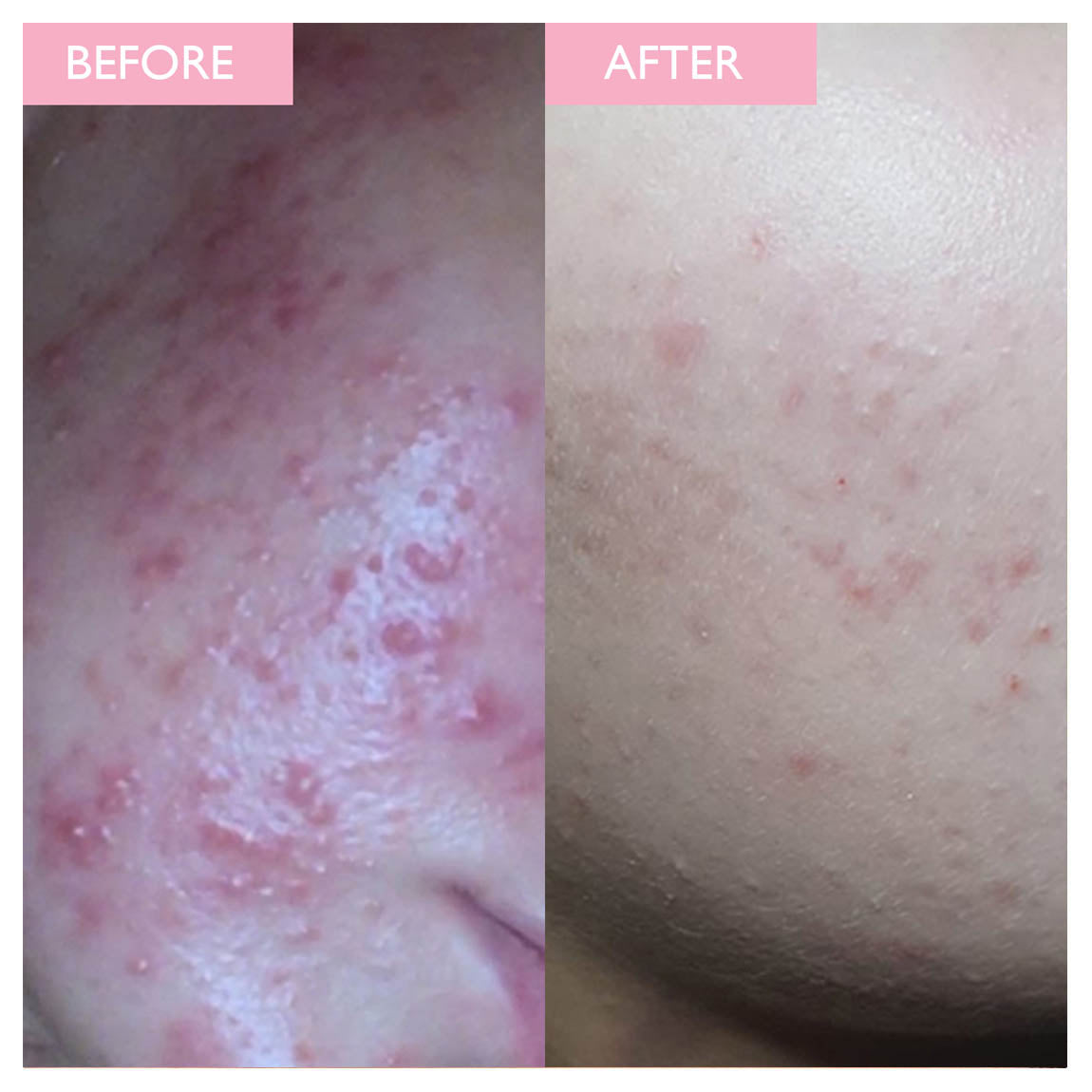 Grape Seed Oil Skin Care - Grape Seed Oil Benefits for Skin – SKINICIAN