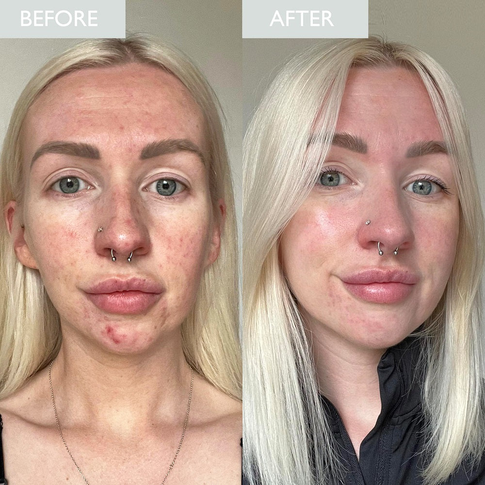 Revitalising Day SPF 30 Moisturiser for Dehydrated Dry Sensitive Skin ...